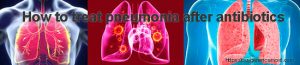 How to treat pneumonia after a course of antibiotics